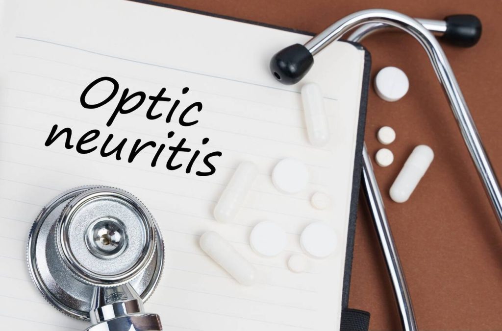 Optic Neuritis: Causes, Risk Factors, Symptoms and Treatment ...