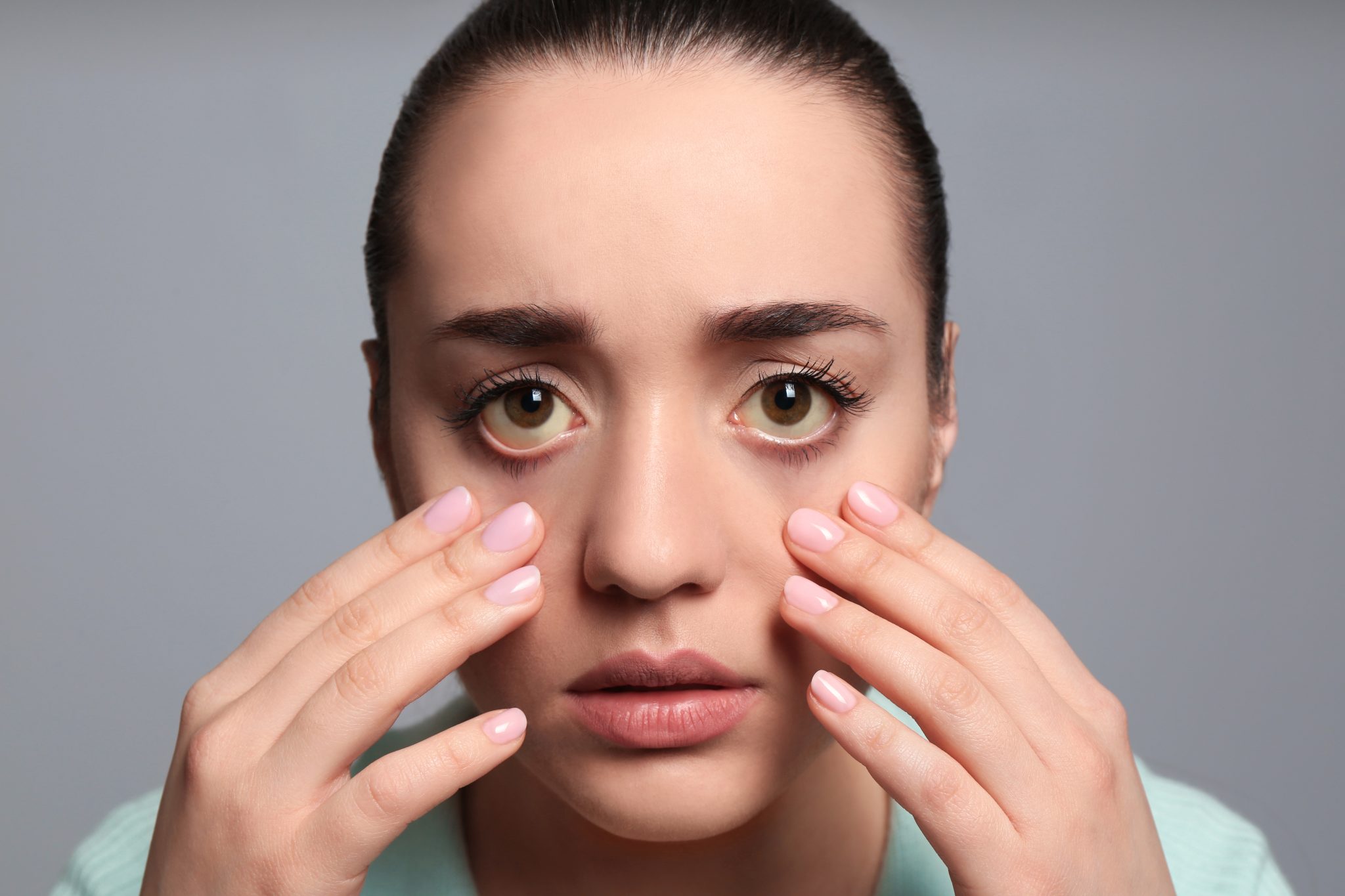 Ptosis: A Comprehensive Guide to Drooping Eyelids – sightconnection